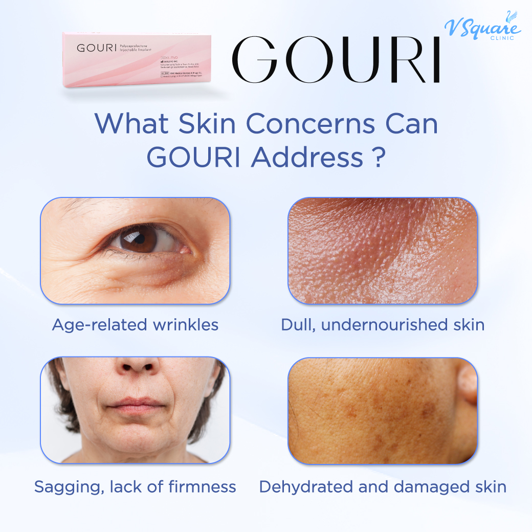 Gouri: What Is It and How Much Does It Cost? 2025 Skin Trend