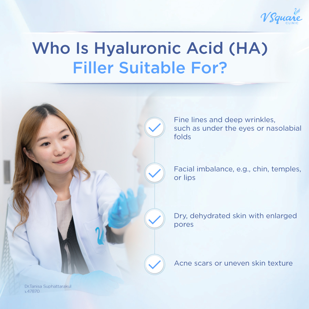 Hyafilia Filler: What It Is, Best Types, and Who It Suits