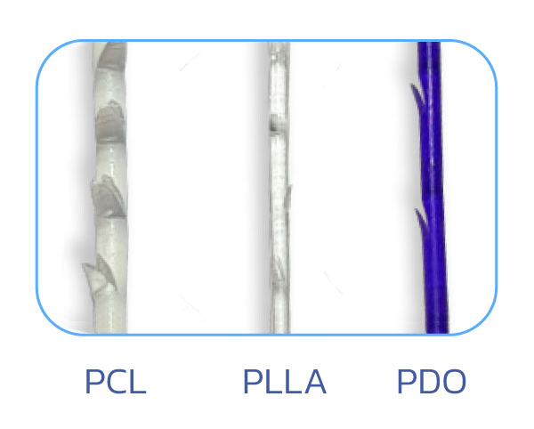 Best Barbed Thread Lift Types in 2026 & Key Differences