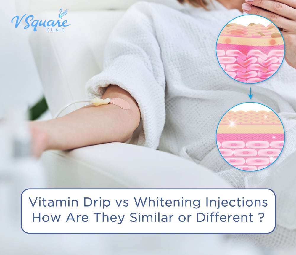 Intravenous Vitamin Therapy – Is It Really Safe?