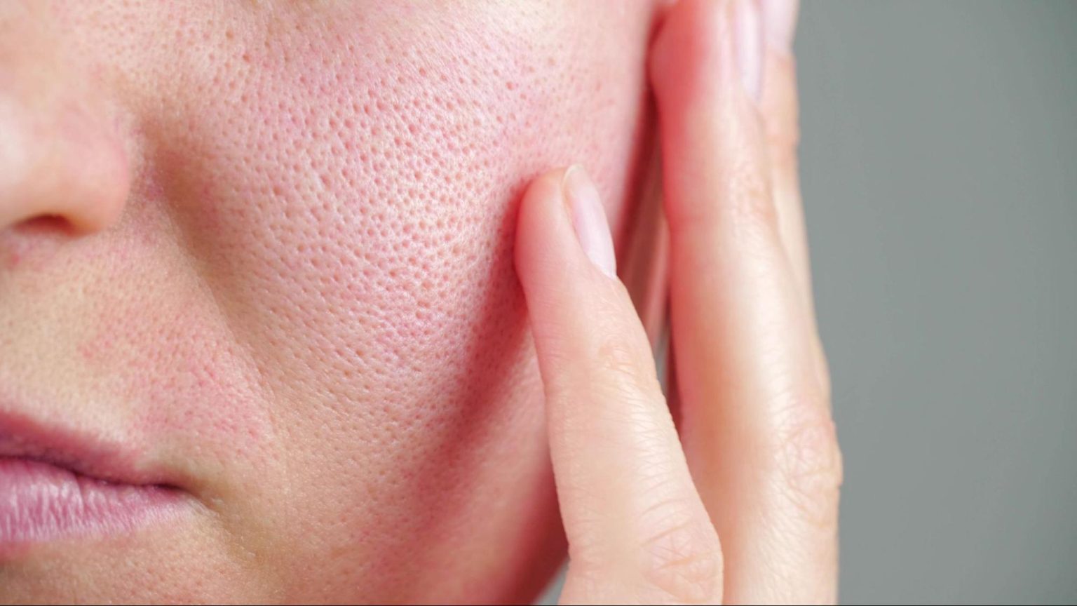 Enlarged Pores: 15 Ways to Tighten and Control Oily Skin